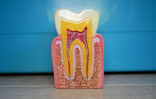 5 Causes Of Root Canal Failure And How To Treat It